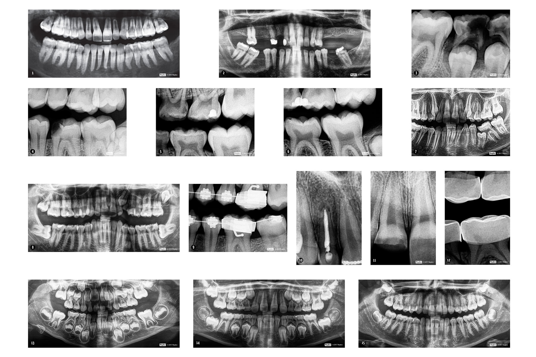 Dental X-Rays - Educational Advantage, Distributor for The Freckled ...